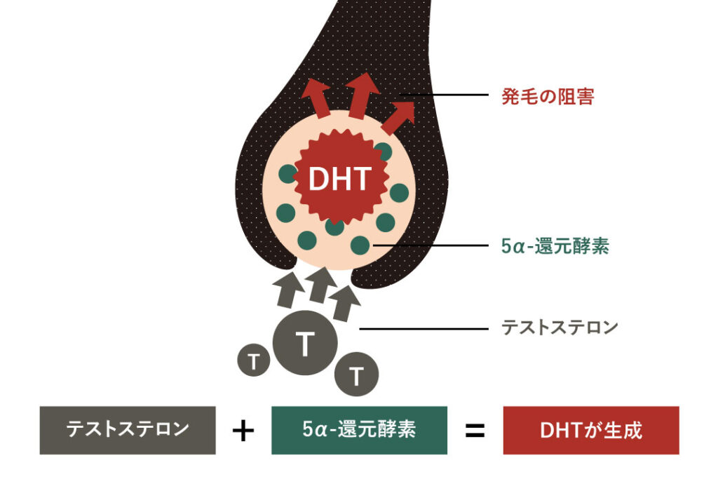 AGAの原因とは | AGA・薄毛治療なら銀座総合美容クリニック（銀クリ）【公式】